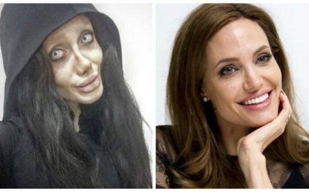 Before And After Photos Of The Woman Rumored To Have Undergone 50 Surgeries To Look Like Angelina